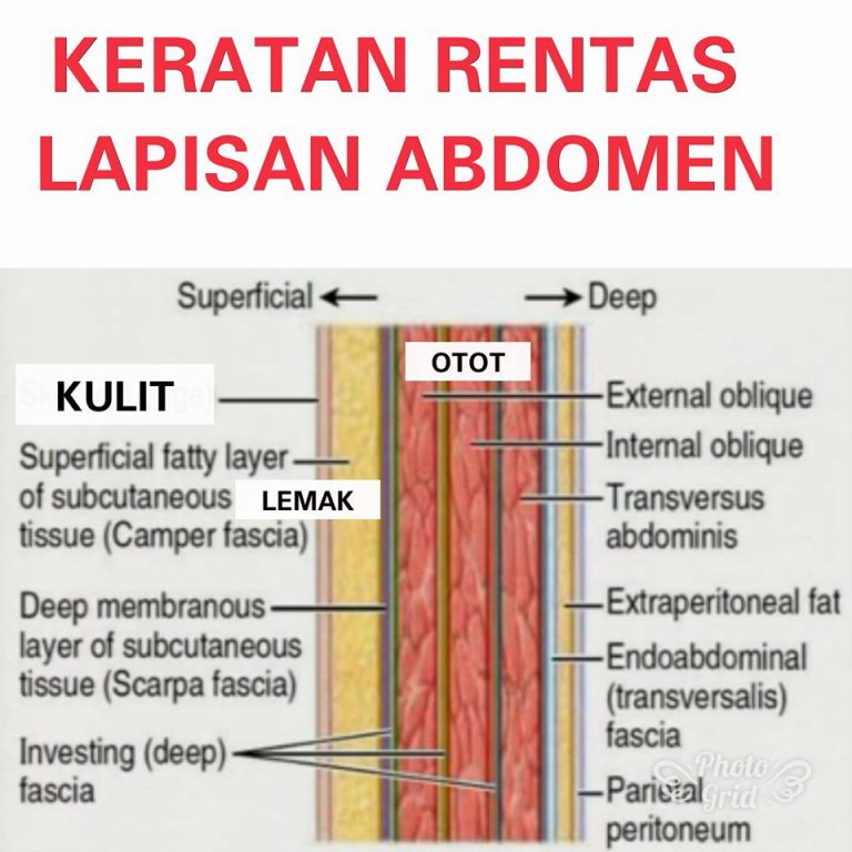 Bertungku Lepas Bersalin Boleh Tapi Doktor Ini Pesan Jangan Berlebihan