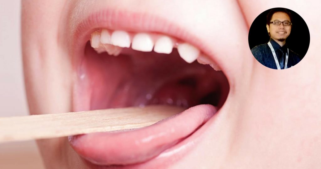 Doktor Jelaskan Ada 5 Sebab Anak Perlu Membuang Tonsil Dan Risikonya ...