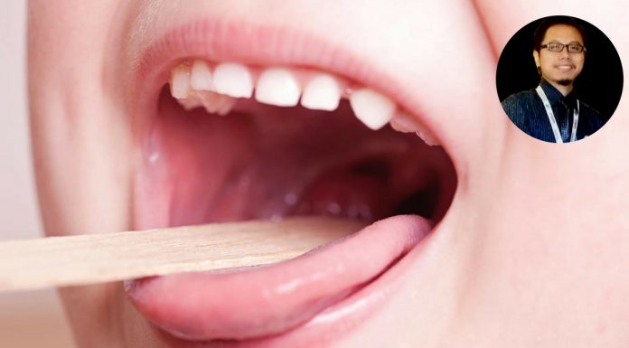 Doktor Jelaskan Ada 5 Sebab Anak Perlu Membuang Tonsil Dan Risikonya ...