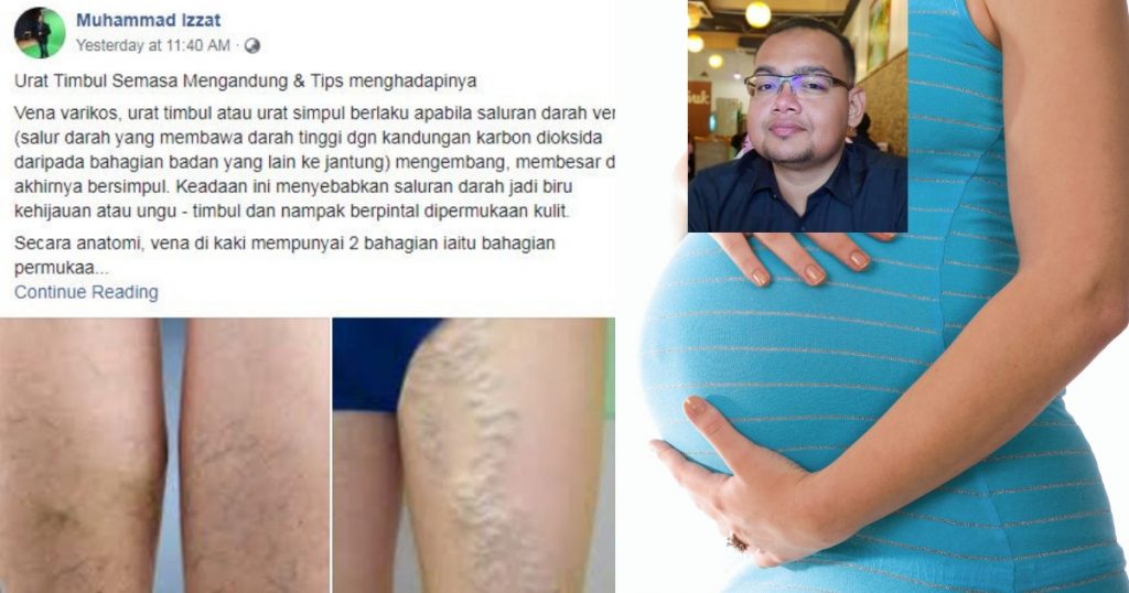 Urat Betis Timbul Masa Mengandung, Perlukah Dirisaukan & Mudaratkah ...