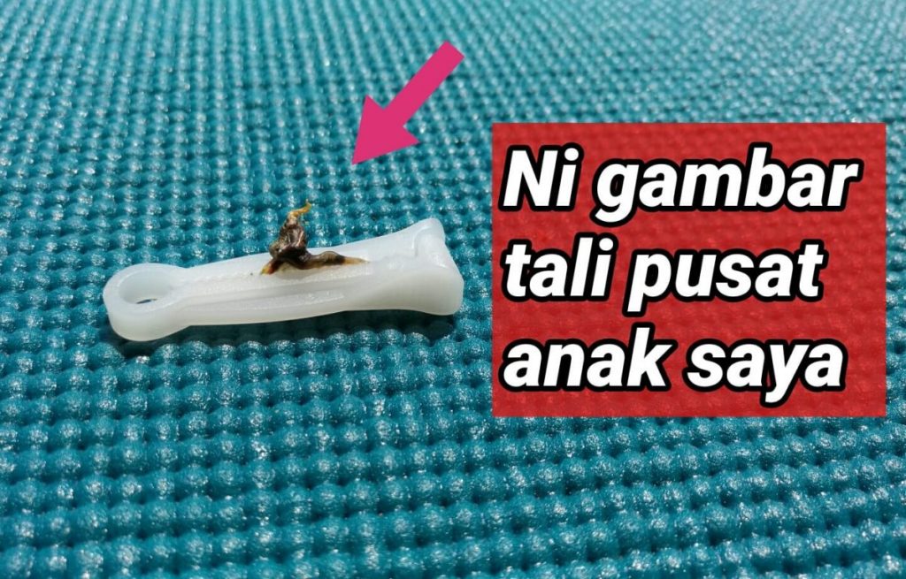 Tersalah Ukur, Bacaan Boleh Jadi Tak Tepat, Doktor Kongsikan Cara Betul ...
