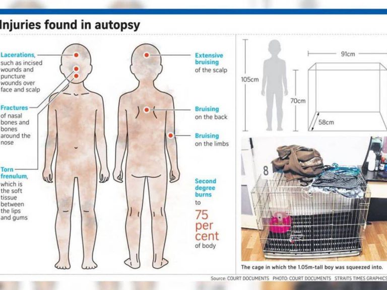 Letak Dalam Sangkar Kucing, Simbah Air Panas. Anak 5 Tahun Meninggal Didera