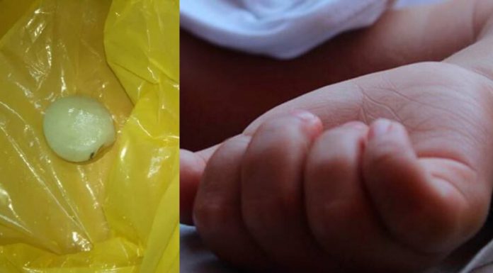 Hanya Sebiji Rambutan, Anak 3 Tahun Maut Tercekik. Bapa Dah Cuba, Allah ...