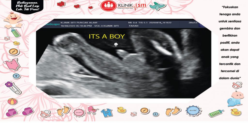 Bayi Menyorok Masa Scan? Banyakkan Minum Air Kosong Sebelum Buat ...