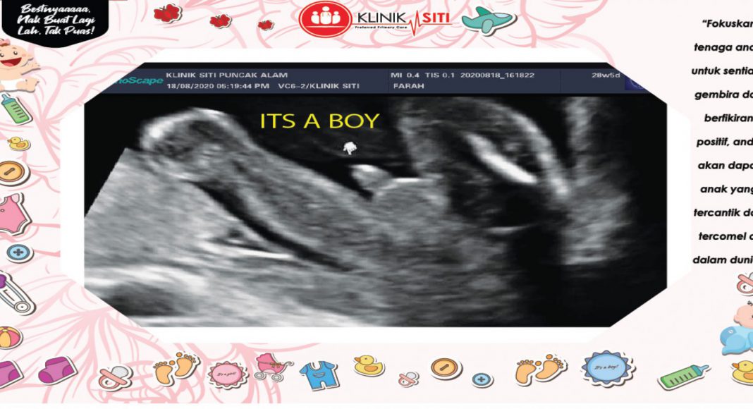 Bayi Menyorok Masa Scan? Banyakkan Minum Air Kosong Sebelum Buat ...