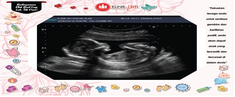 Bayi Menyorok Masa Scan? Banyakkan Minum Air Kosong Sebelum Buat ...