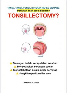 Anak Tidur Berdengkur, Dalam Setahun Kerap Sakit Tekak, Mungkin Tonsil ...