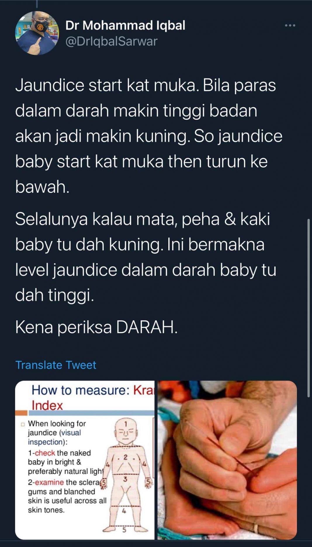 Doktor Kongsi Cara Betul Guna Nasal Spray & Nasal Decongestion Untuk ...
