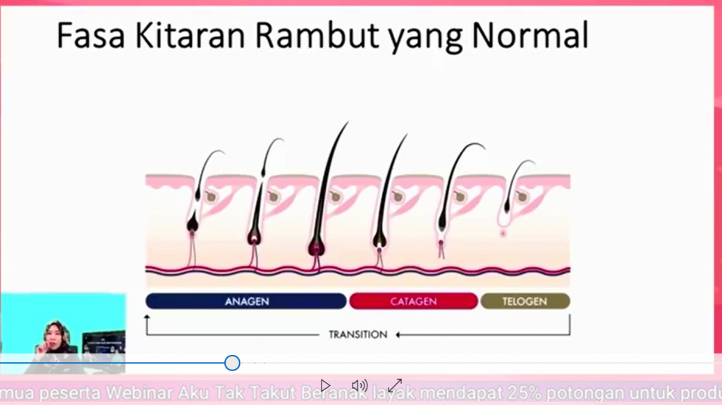 Cara Atasi Rambut Gugur Selepas Bersalin