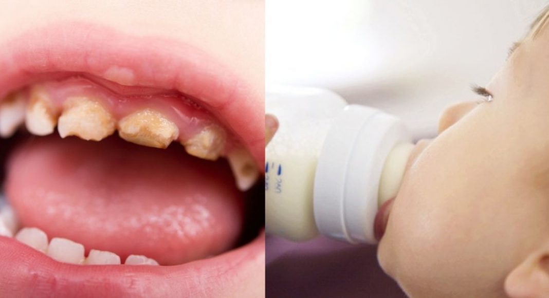 Kaki Tiba-tiba Kejang, Jangan Pandang Ringan Simpul Mengkarung