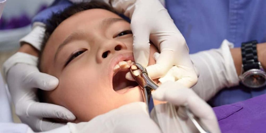 Suka Menyusu Botol Antara Penyebab Karies Gigi Anak, Ini Cara Cegah ...