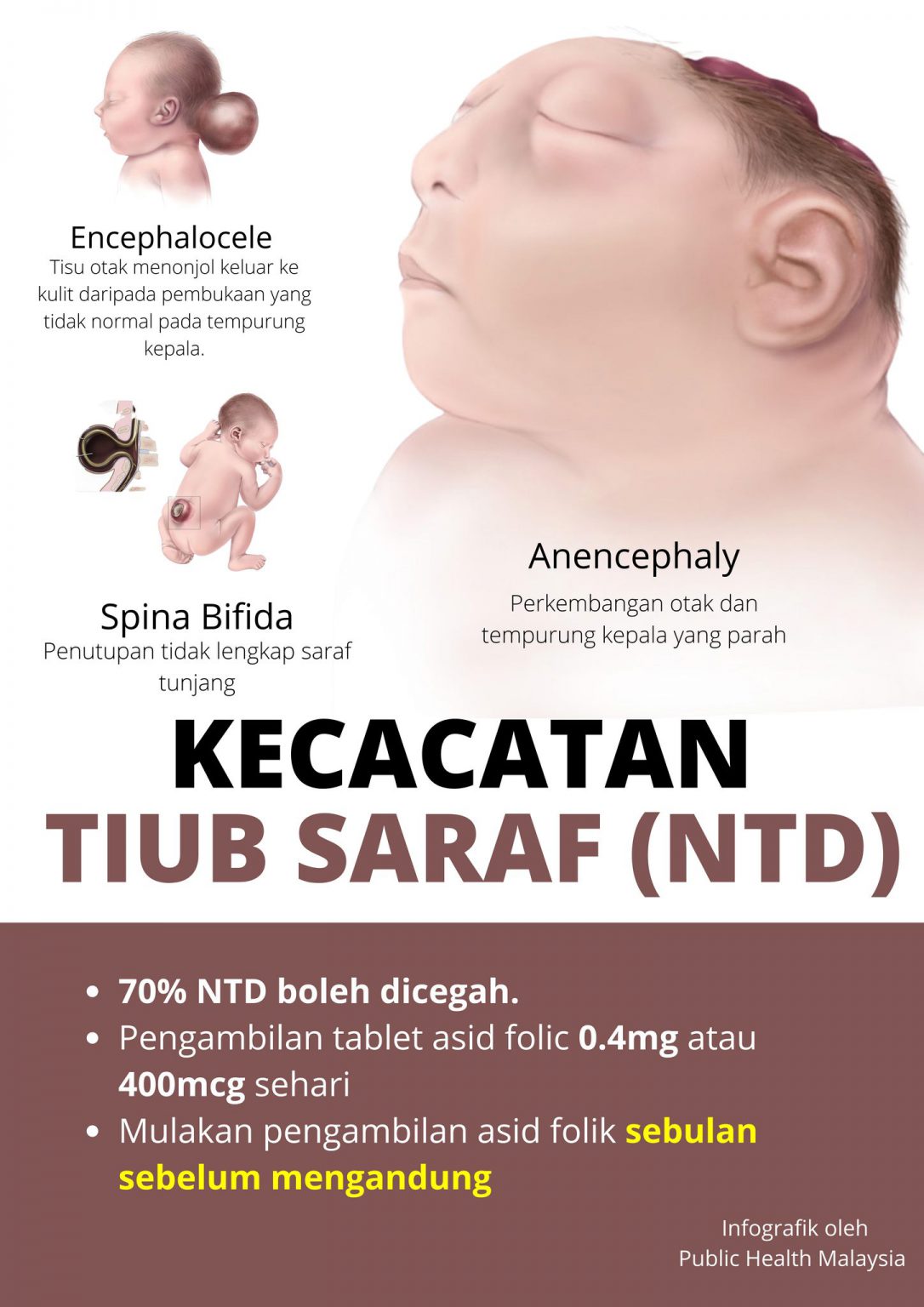 Cegah Kecacatan Bayi, Sebaiknya Sebelum & Awal Mengandung Makan Asid Folik