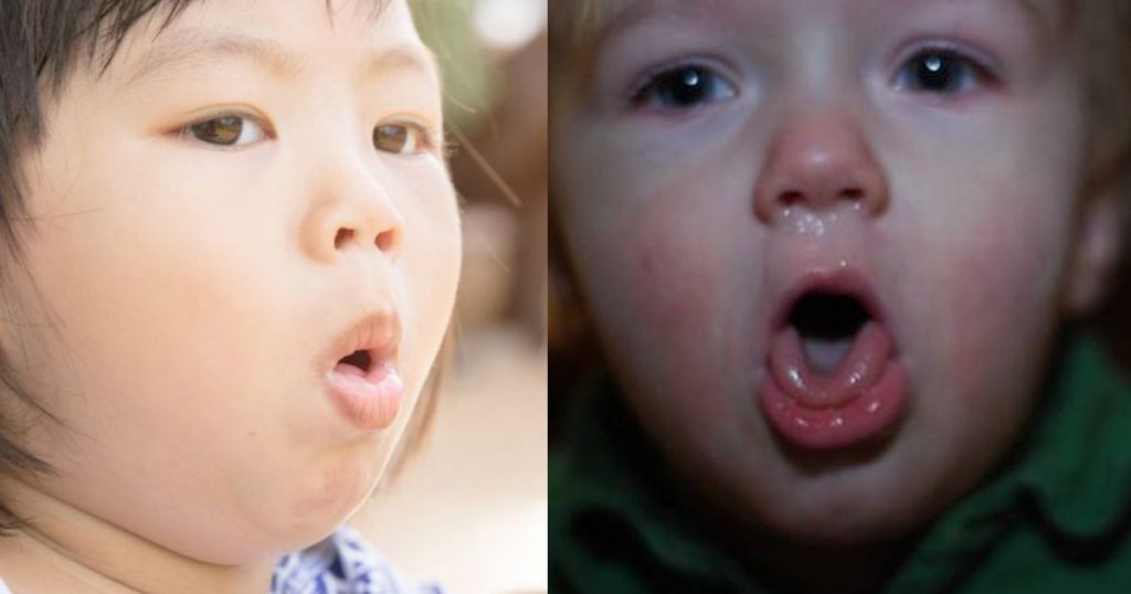 Batuk Jika Berterusan Mesti Ada Tak Kena. Ini 7 Jenis Batuk & Simptom ...