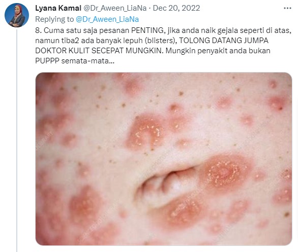 Mengandung Dan Gatal-Gatal Dekat Perut, Rupanya Penyakit PEP